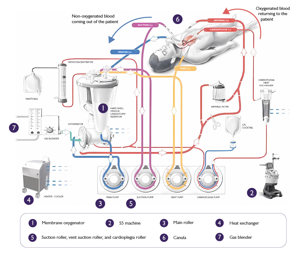 Cardiopulmonary Will Resuscitative Endovascular Balloon Occlusion Of Cardiopulmonary Will Resuscitative Endovascular Balloon Occlusion Of