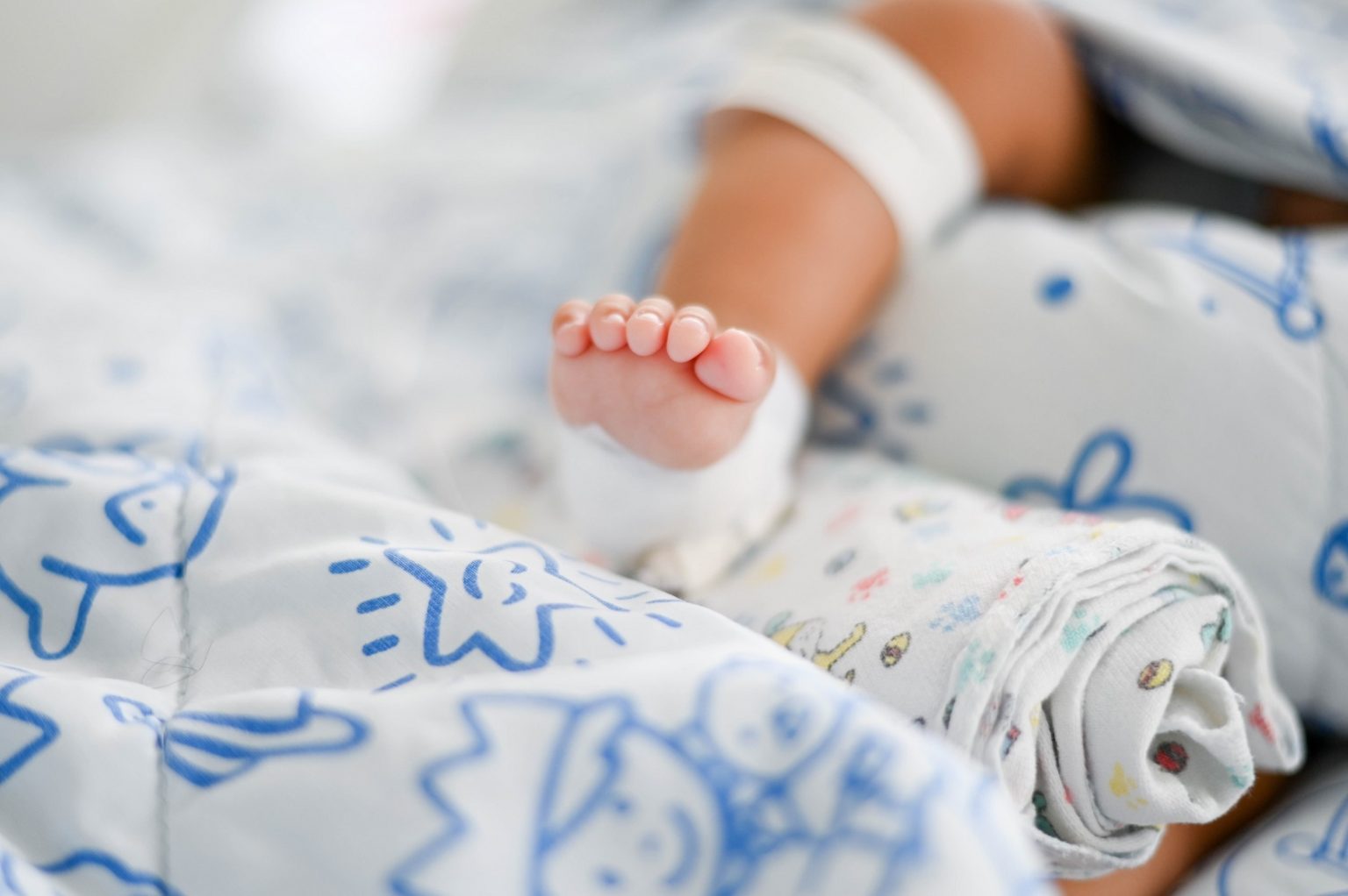 Síndrome de Patau: o que é a trissomia 13?